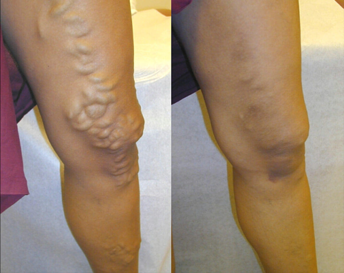 A vascular doctor from London has invented and patented the first ...